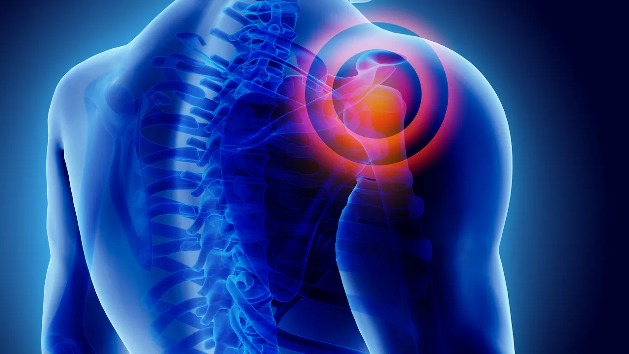 Shoulder Innovations: Advancing Shoulder Replacement Options - Alumni ...